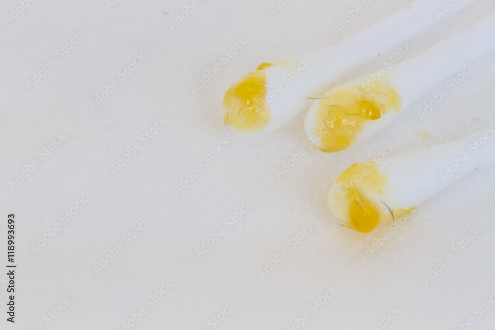 Gray Ear Wax