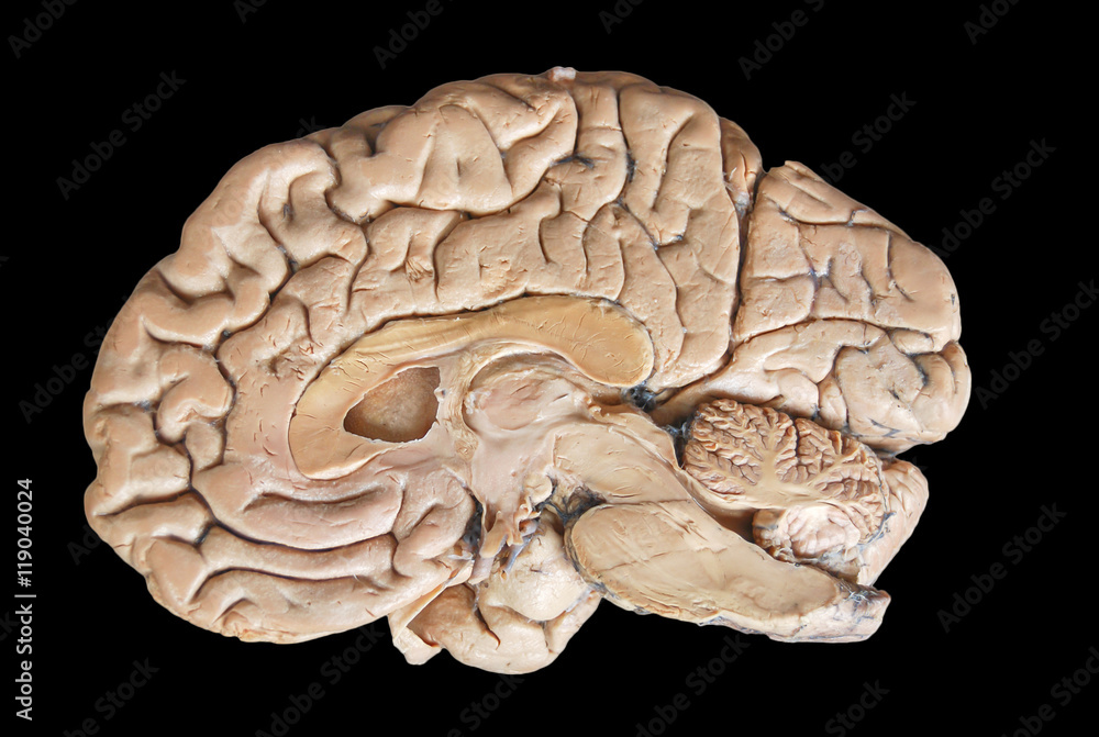 Real Human Brain Labeled