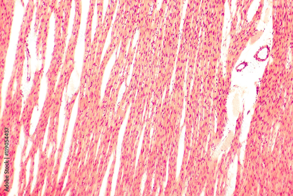 Foto Stock Heart muscle, light micrograph. Striated cardiac muscle ...