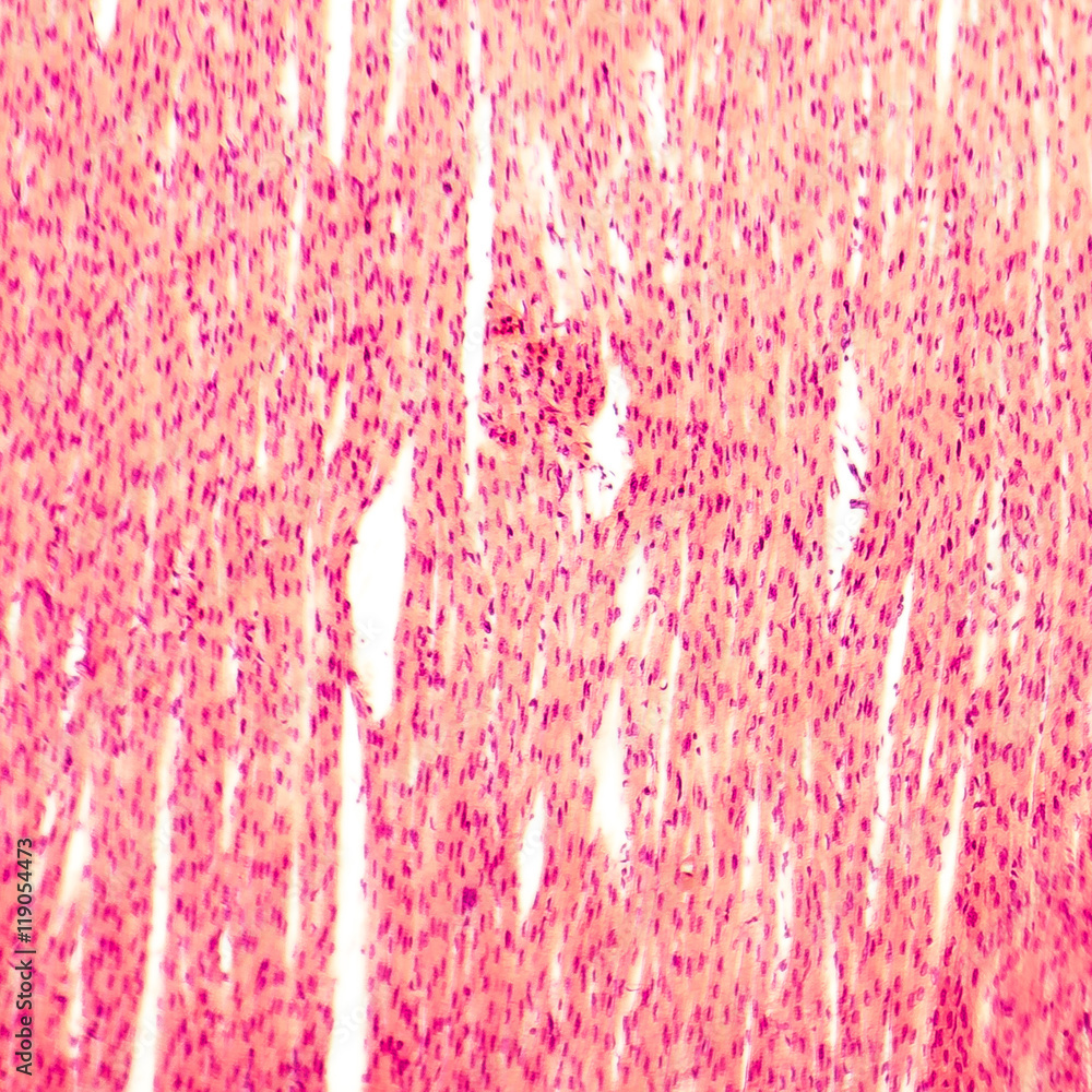 Heart muscle, light micrograph. Striated cardiac muscle cells (myocytes ...