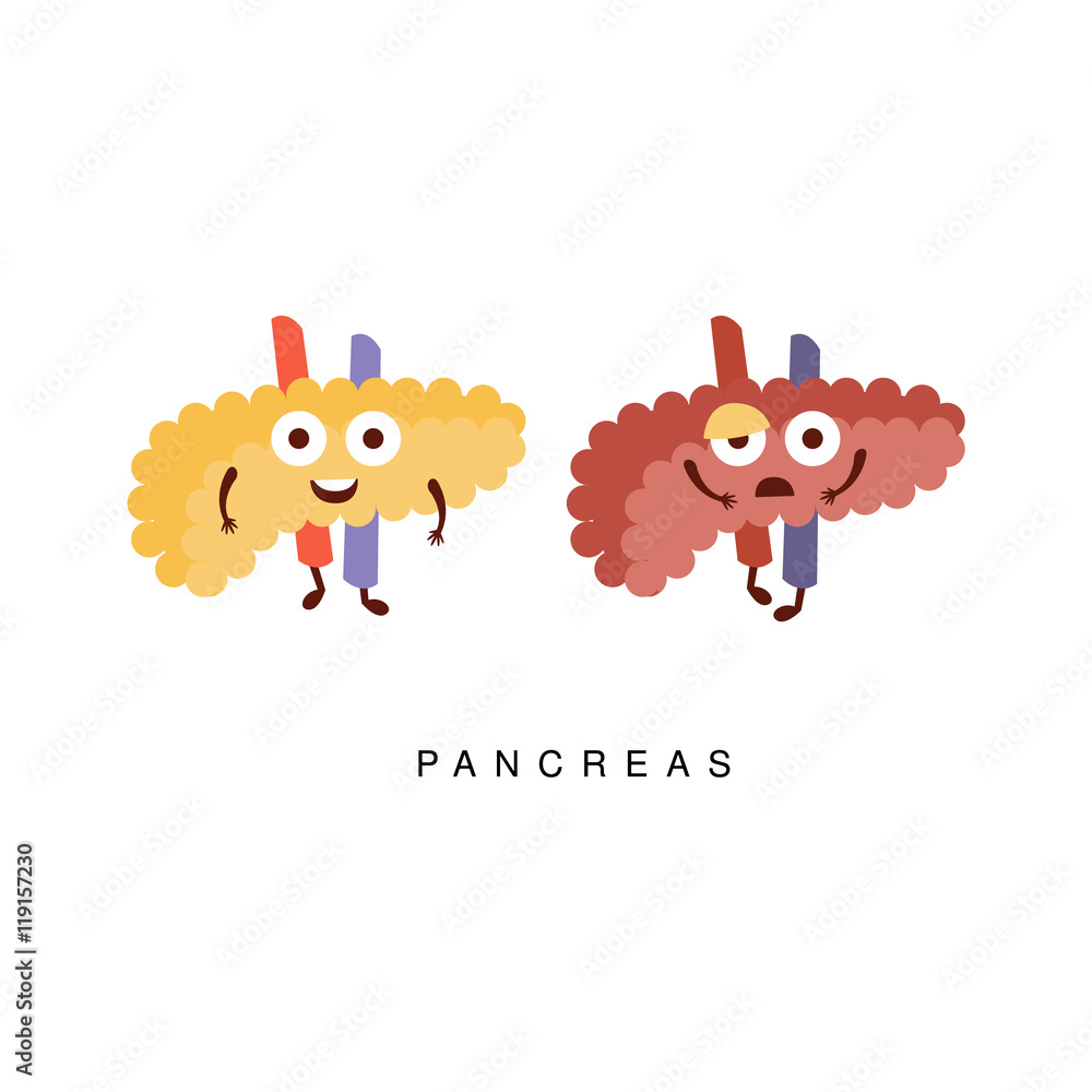Healthy vs Unhealthy Pancreas Infographic Illustration Stock Vector ...
