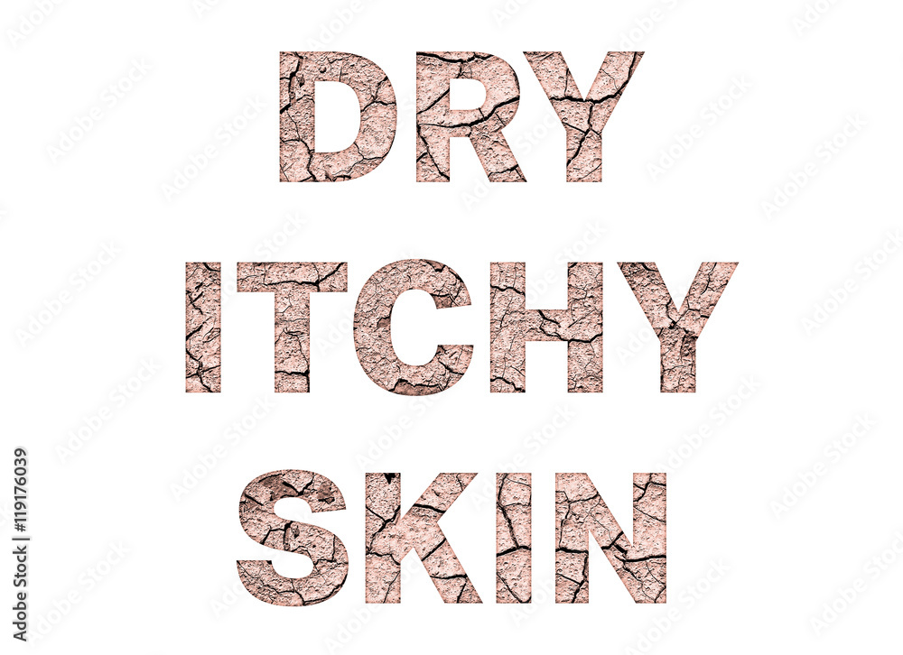 Dry Itchy skin word concept on white background Stock Photo | Adobe Stock