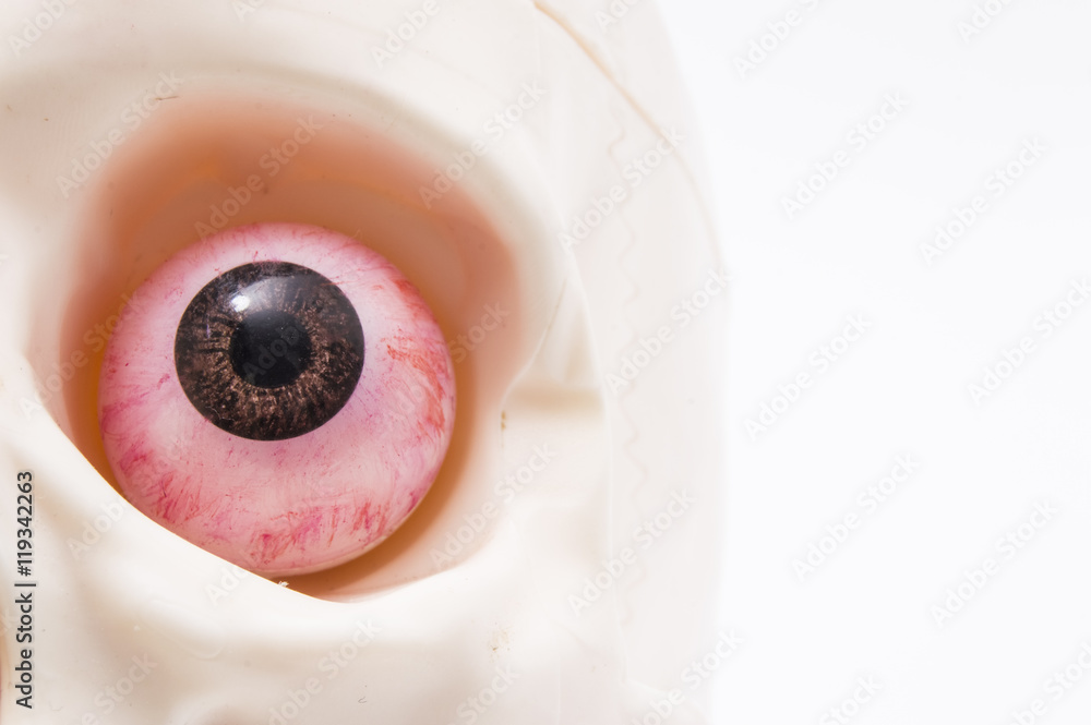 Red eye (medicine) or redness of the eye with the appearance of blood ...