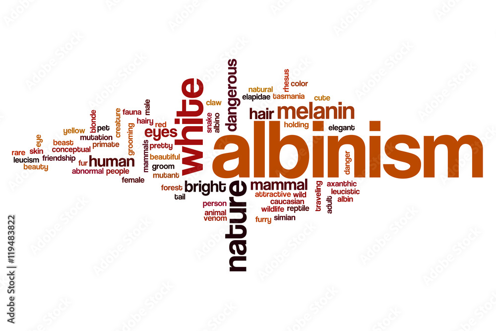Albinism word cloud Stock Illustration | Adobe Stock