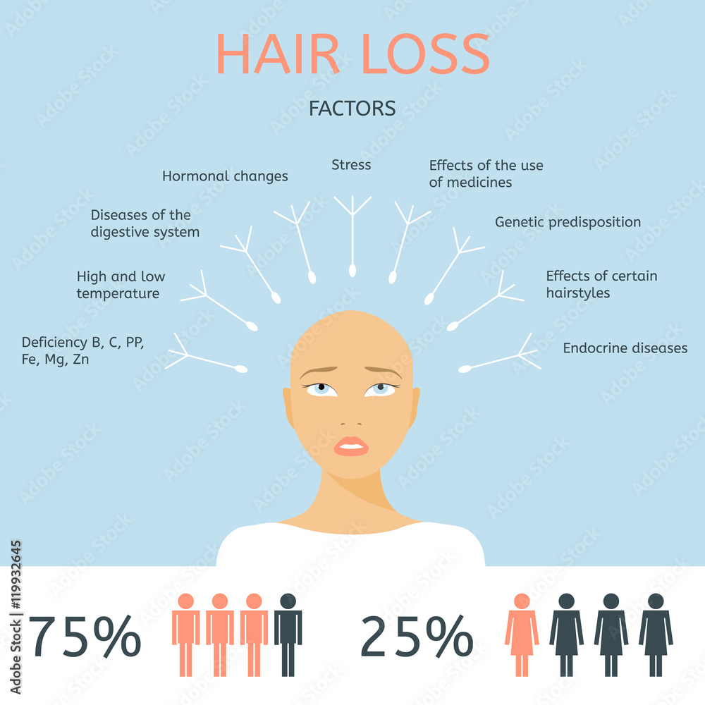 Bald girl. Factors of hair loss. Alopecia infographics. Stock Vector ...