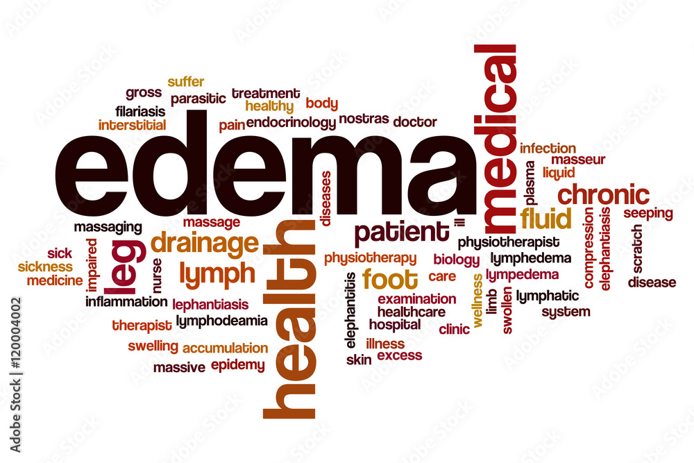 Edema word cloud Stock Illustration | Adobe Stock