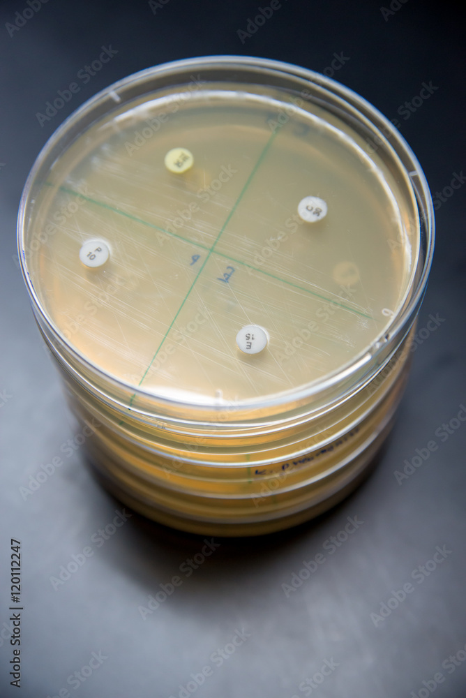 E Coli Plate
