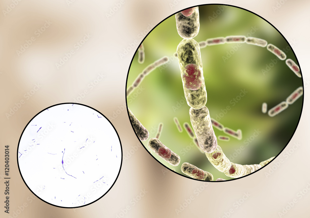 Bacillus anthracis, light micrograph and illustration Stock ...