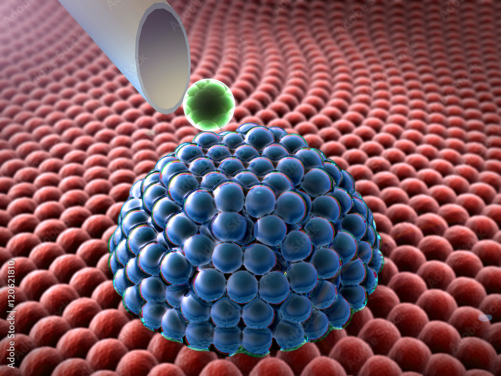 chemotherapy, the medicine was injected through a syringe, Treatment of ...