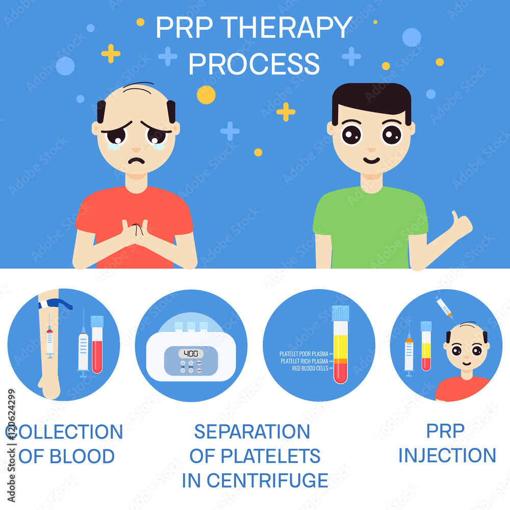 Platelet rich plasma injection procedure. PRP therapy process for men ...