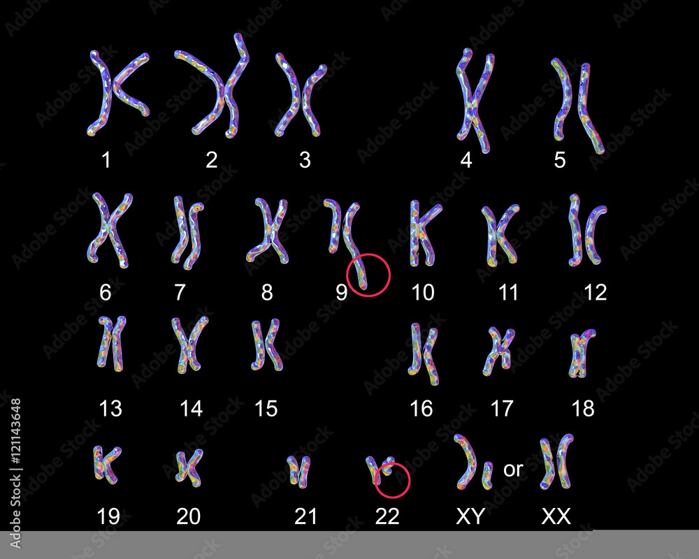 Philadelphia chromosome karyotype male or female. 3D illustration ...