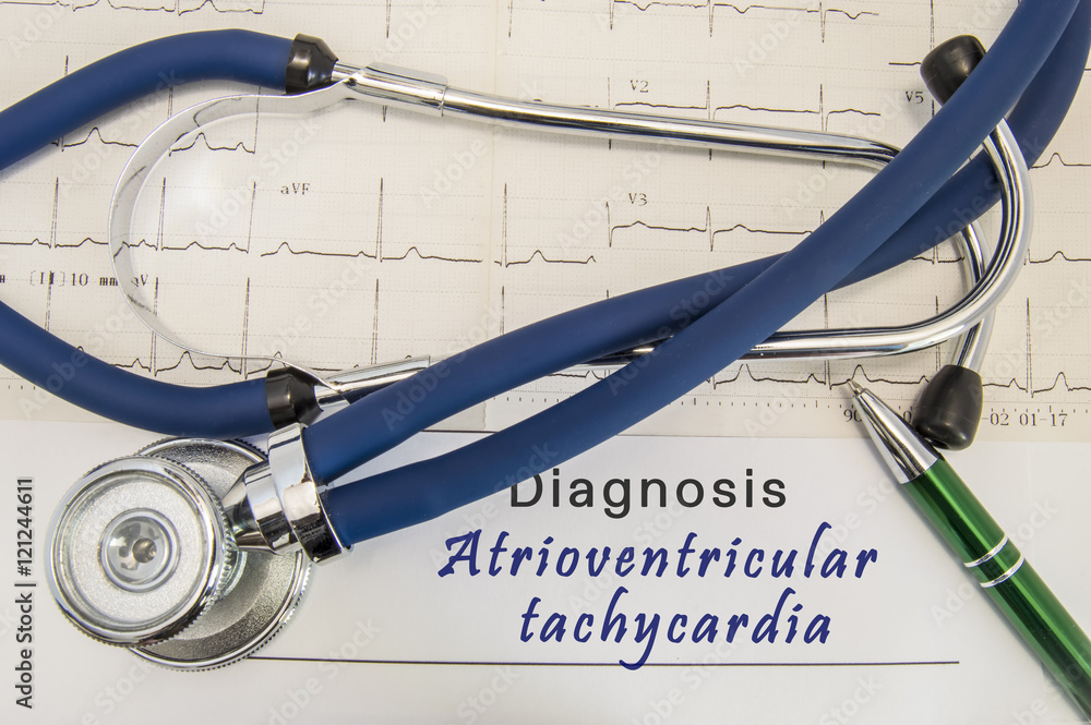 Diagnosis of Atrioventricular tachycardia. Stethoscope and recorded ...