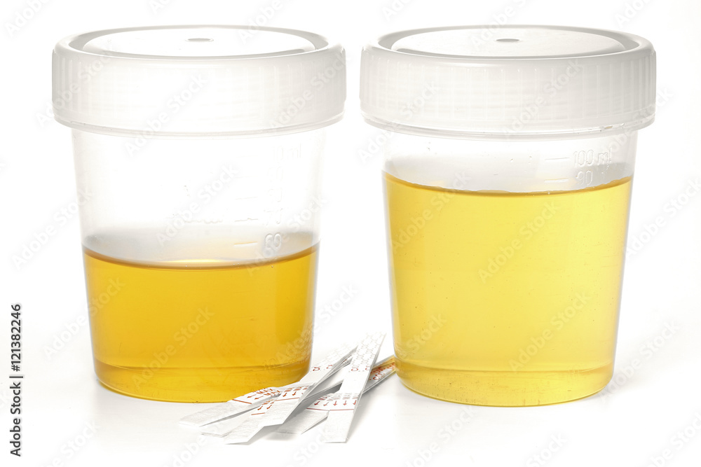 Urintestbecher mit Kontrollstreifen isoliert auf weißem Hintergrund ...
