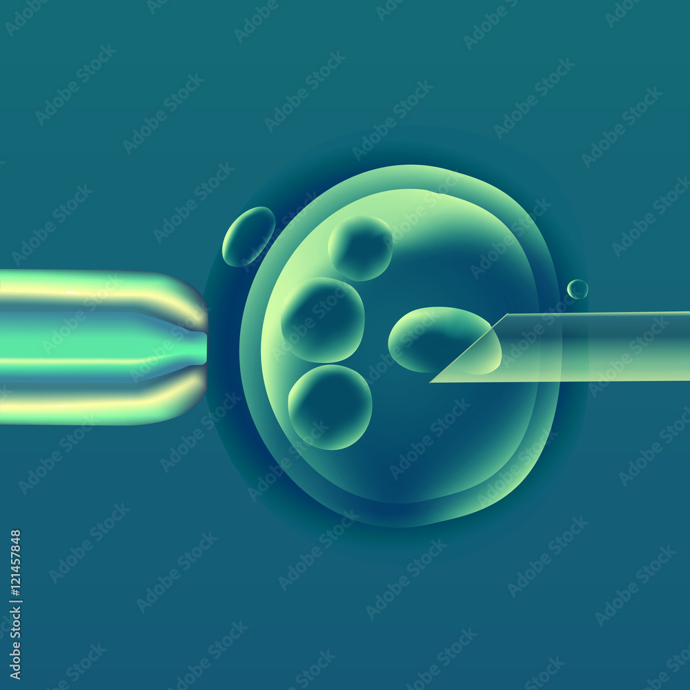 In vitro fertilization IVF , the egg ovum , pipette and pipe horizontal ...