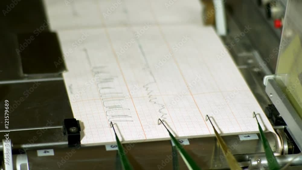 Readout or printout from a polygraph machine as a result of a lie ...