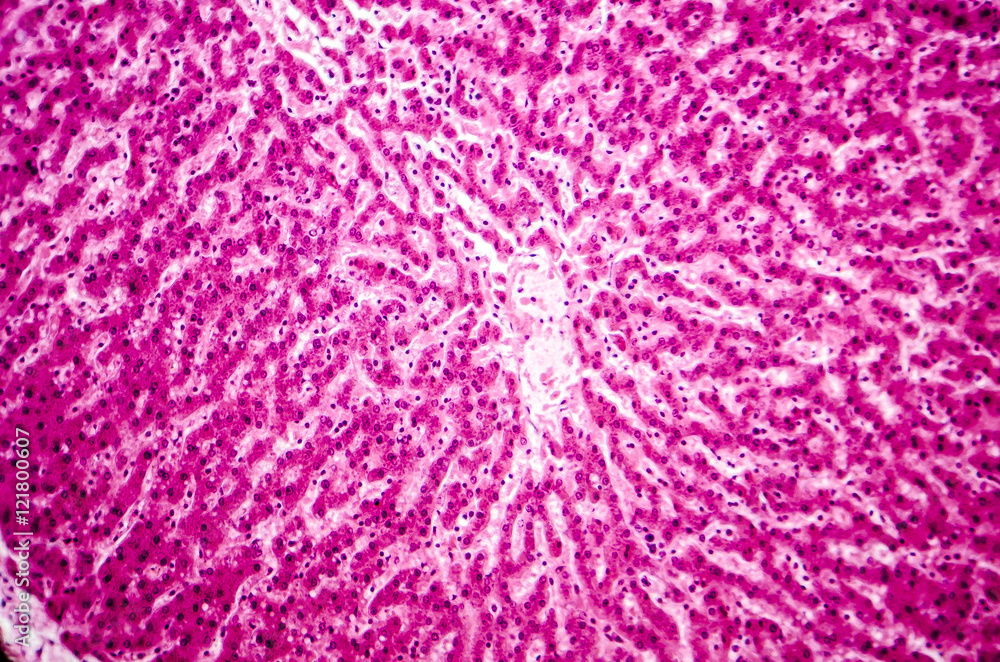 Light micrograph of a liver showing cords made from hepatocytes and ...