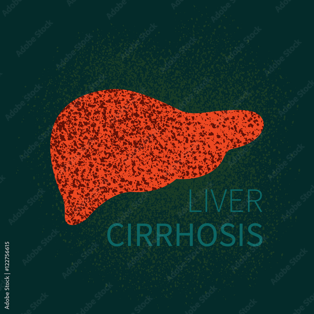 Liver cirrhosis disease design template. Human body organs anatomy icon ...