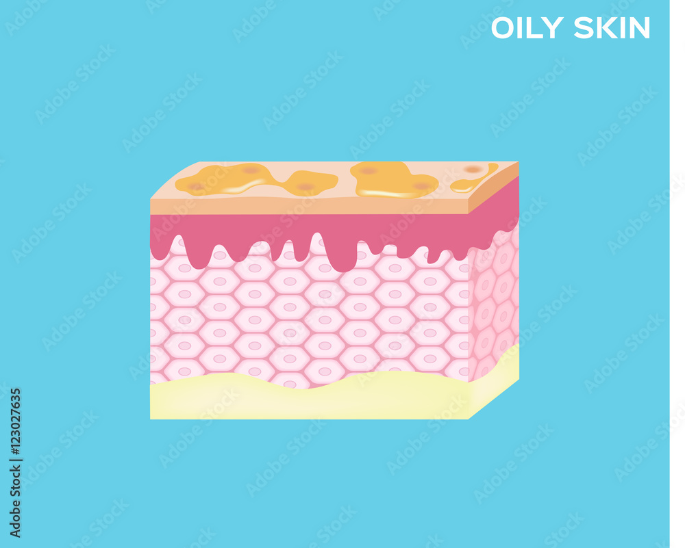 oily skin texture , vector , oily skin icon Stock Vector | Adobe Stock