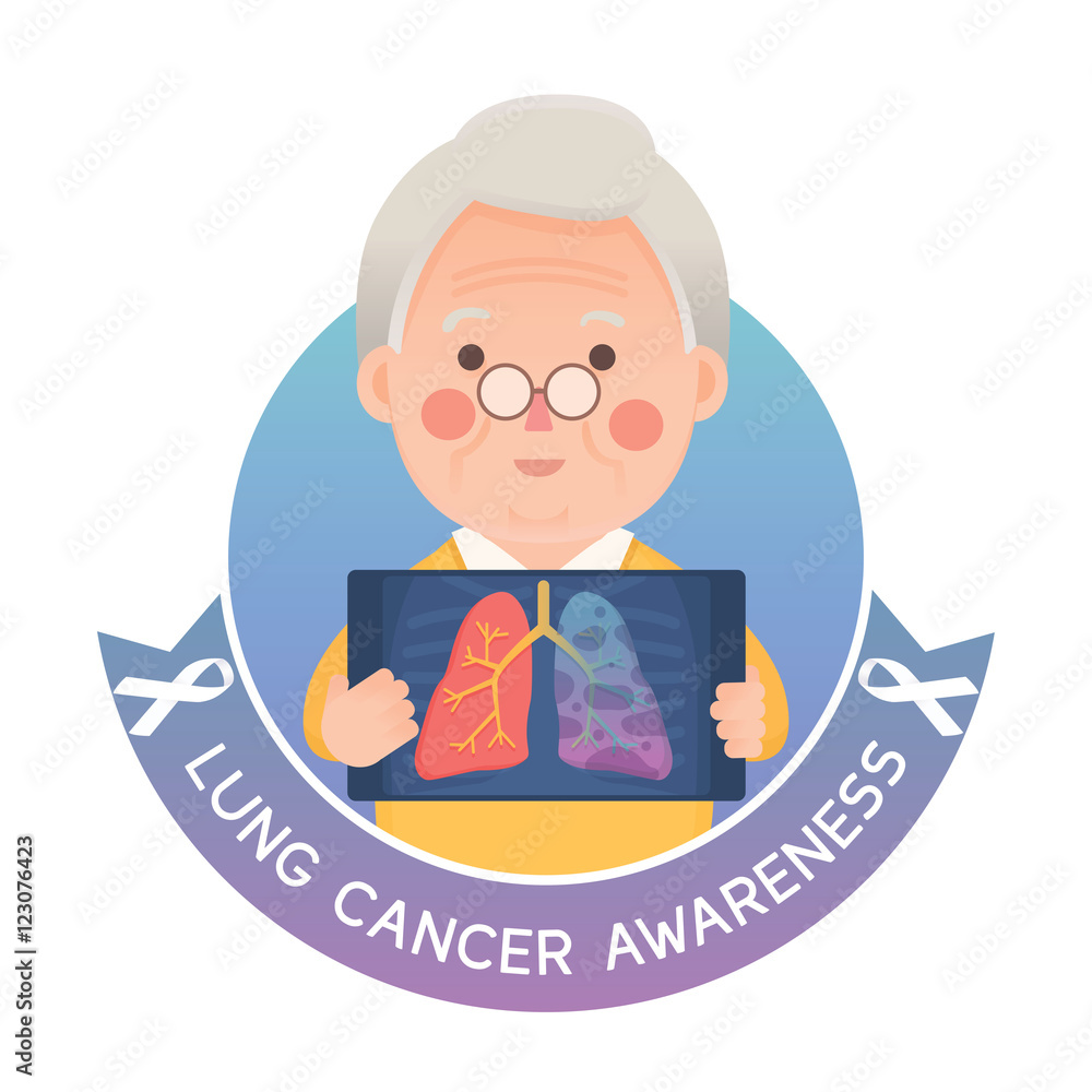 Vector Illustration of Old Man Holding X-ray Image Showing Lung Cancer ...