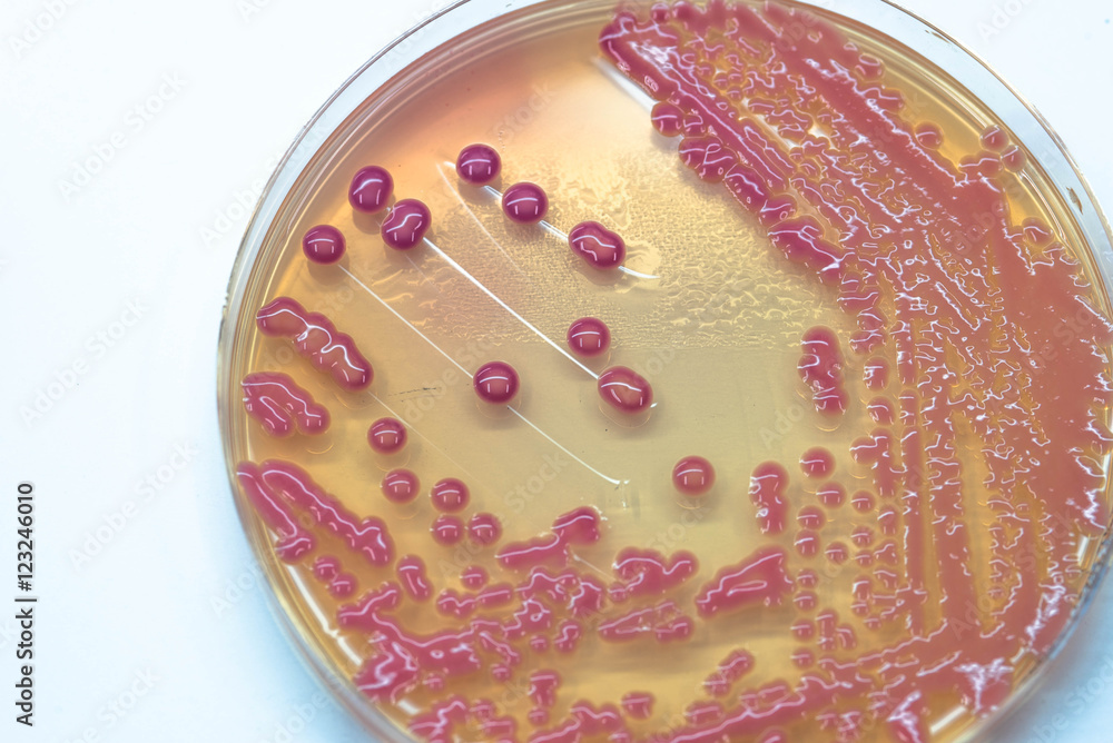 Bacterial colonies culture growth on MacConkey agar (MAC agar). Stock ...