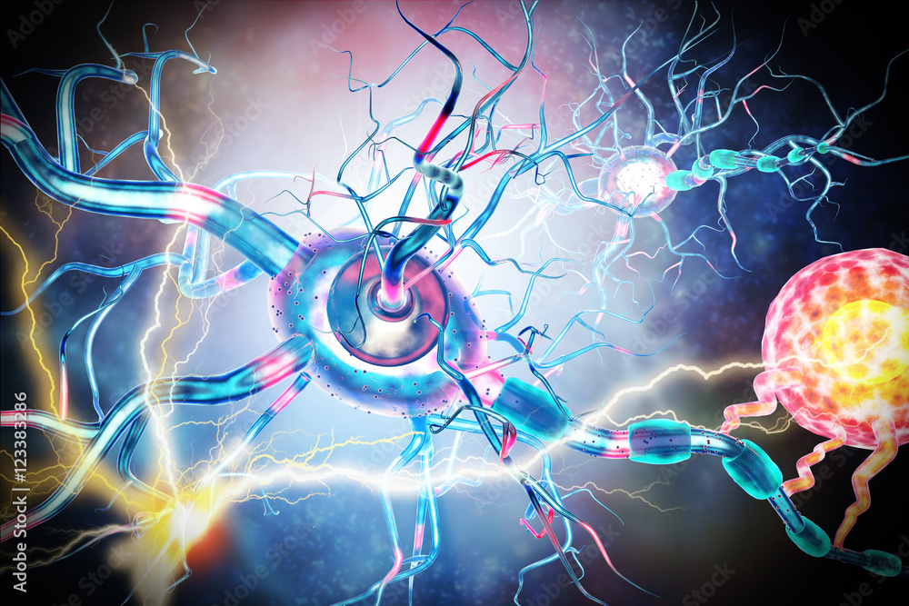 Damaged nerve cells, concept for neurodegenerative and neurological ...