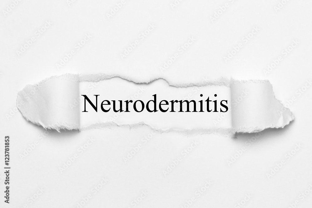 Neurodermitis auf weißen gerissenen Papier Stock Photo | Adobe Stock