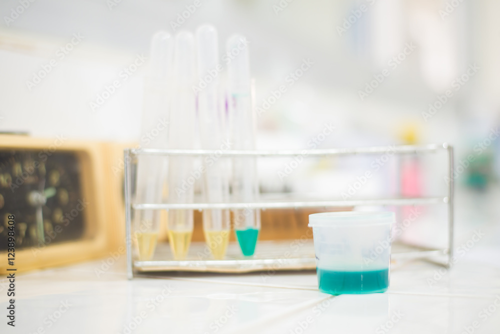 Blue urine complication of drug and normal yellow urine. Stock Photo ...