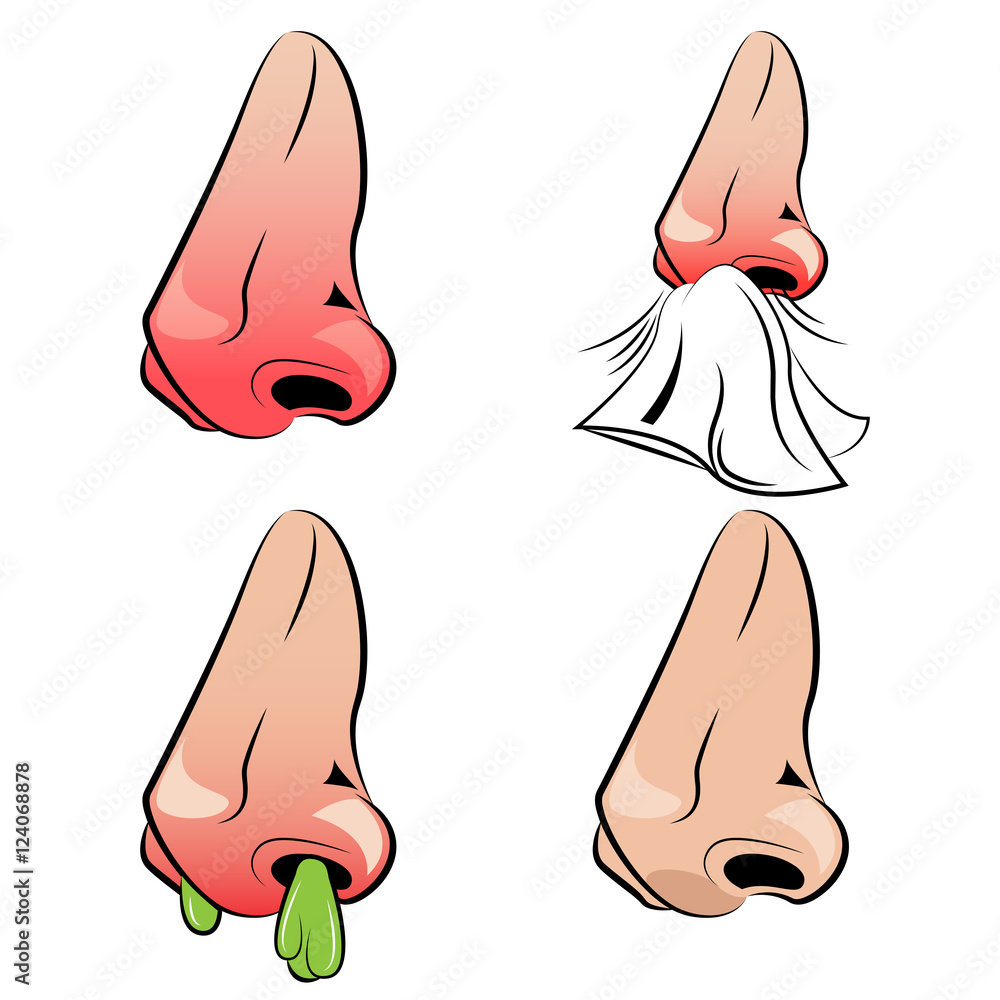 Runny Nose Set Stock Vector | Adobe Stock