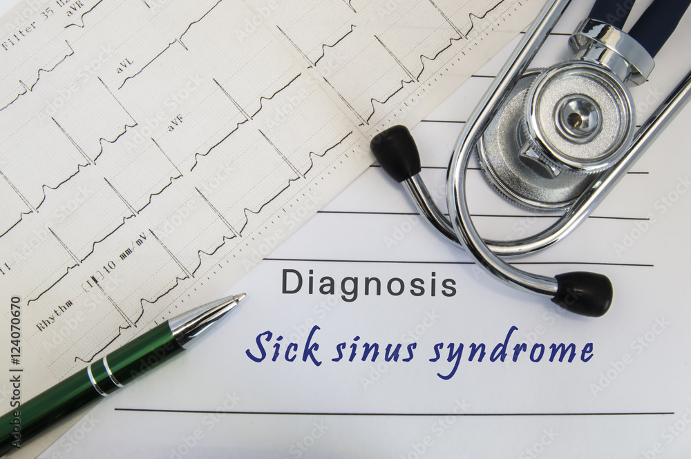 Diagnosis of Sick sinus syndrome. Stethoscope, green pen and ...