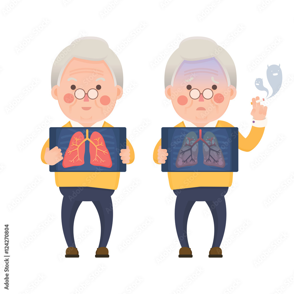 Vector Illustration of Happy Old Man Holding X-ray Image Showing ...