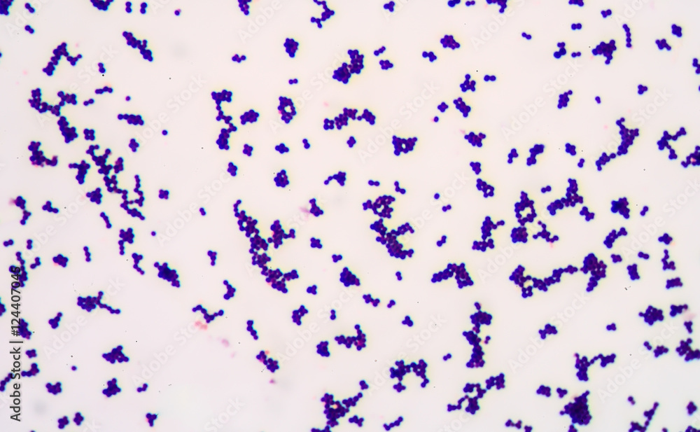 Gram staining, also called Gram's method, is a method of differe Stock ...