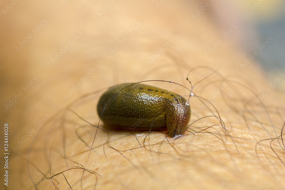 leech on human skin Stock Photo | Adobe Stock