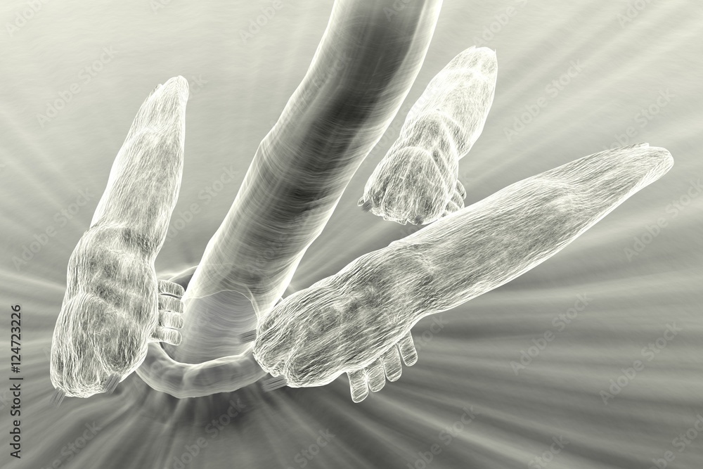 Demodex folliculorum parasite that causes demodicosis illustration ...