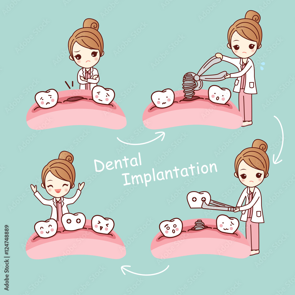 cartoon tooth dental implantation concept Stock Vector | Adobe Stock
