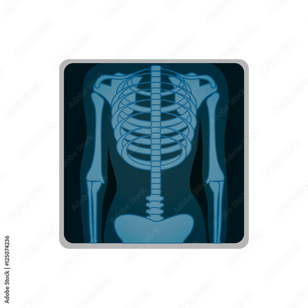 chest x-ray icon image vector illustration design Stock Vector | Adobe ...