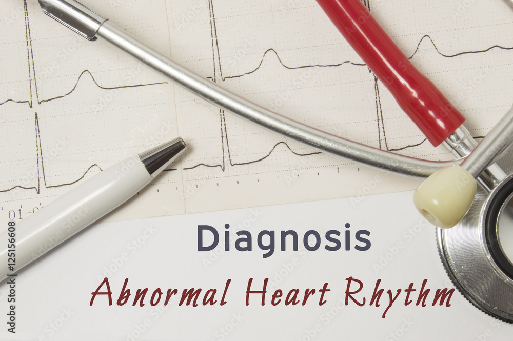 Cardiac diagnosis of Abnormal Heart Rhythms. On doctor workplace is ...