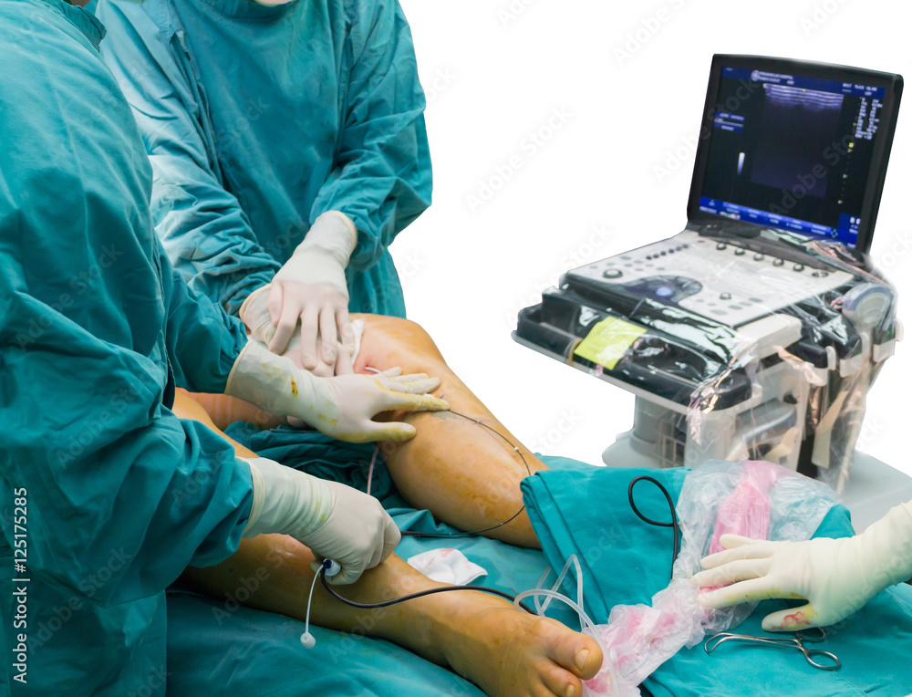 Doctor surgery foot Suture,Percutaneous transluminal angioplasty ...