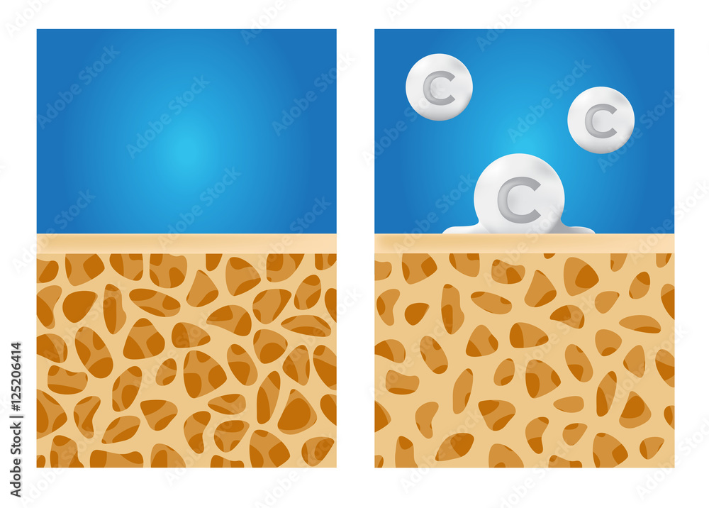 calcium apply on a bone and make it strong . anatomy Stock Vector ...
