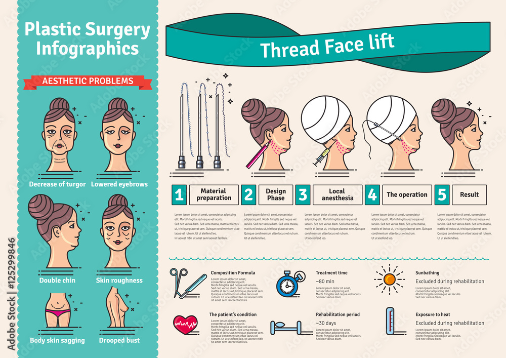 Vector Illustrated set with face lifting surgery by threads Stock ...