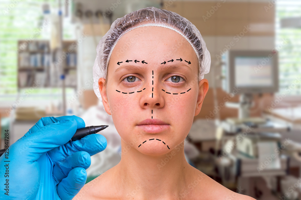 Plastic surgery doctor draw lines with marker on patient face Stock ...