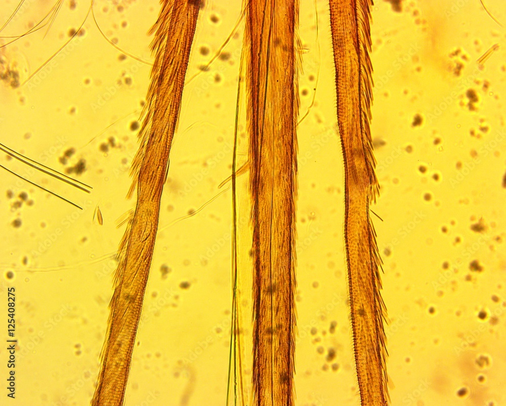 Anopheles mosquito (Anopheles sp.) proboscis - permanent slide plate ...