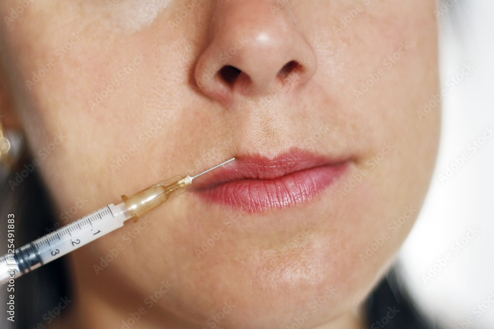 Woman receiving a botox injection in her lips, close up. Treatment with ...