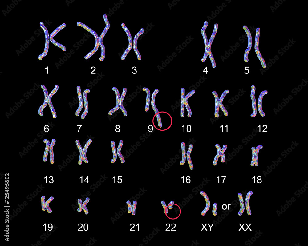 Philadelphia chromosome karyotype male or female. 3D illustration ...