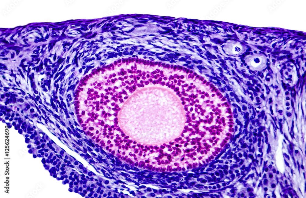 Light micrograph of ovary showing follicle. Magnification 100x. Colors ...