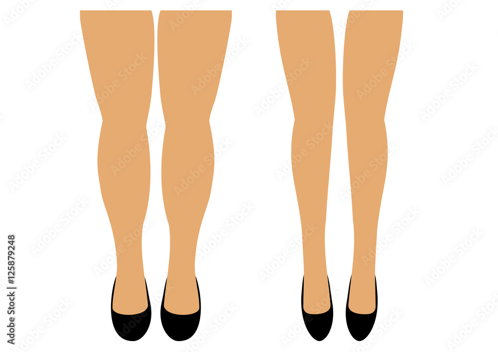 Women's legs two pairs of thin and full vector illustration Stock ...