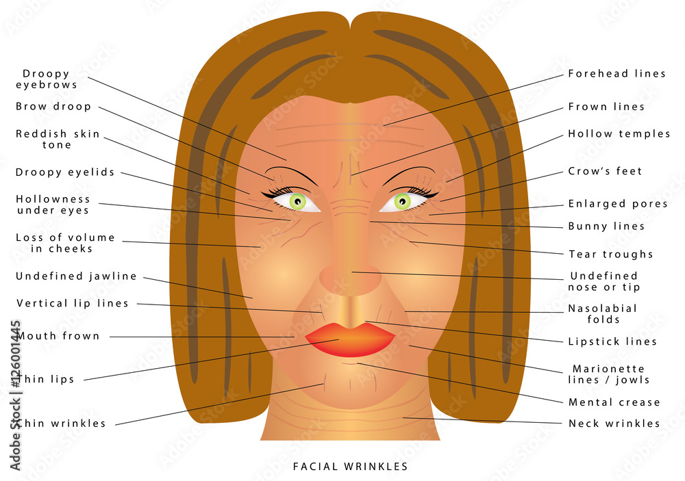 Ageing face changes. Facial Wrinkles. Folds and wrinkles on the face of ...