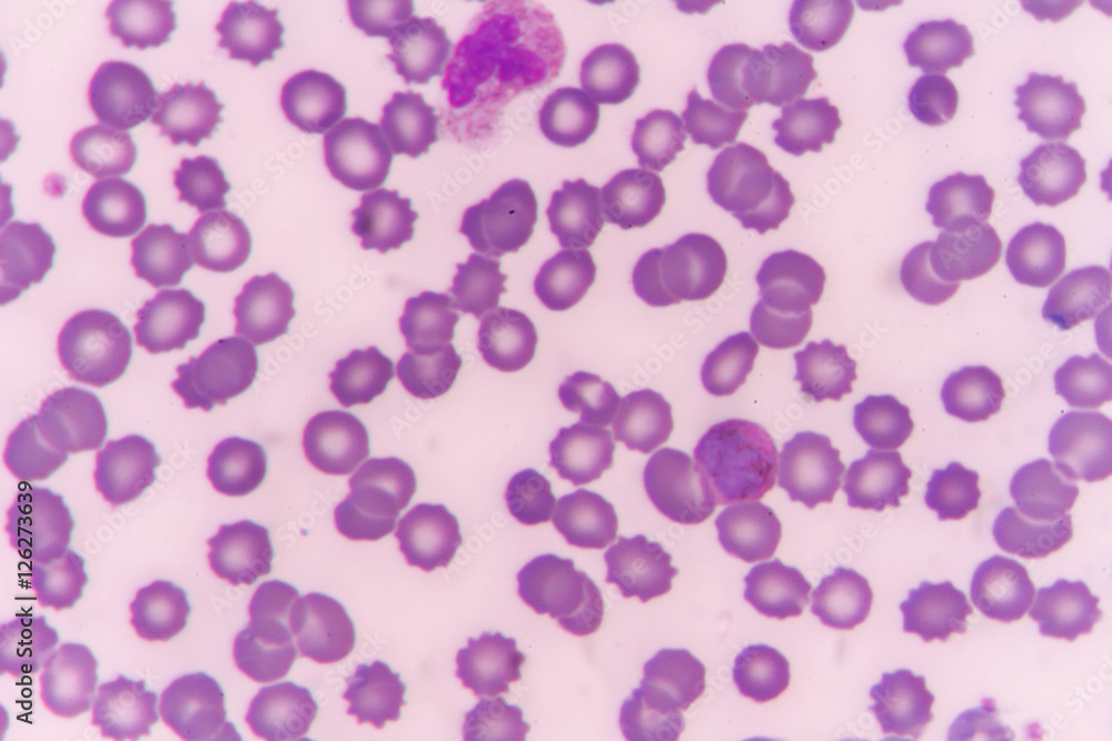 plasmodium malariae trophozoite (band form) Stock Photo | Adobe Stock