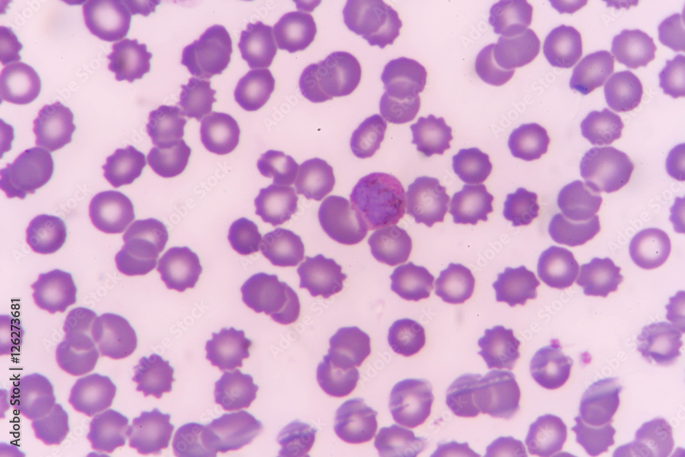 plasmodium malariae trophozoite (band form) Stock Photo | Adobe Stock