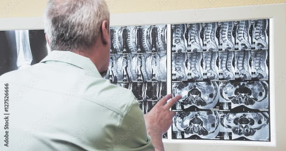 Male doctor reviewing CT MRI images 4k video. Orthopedist looks on x ...