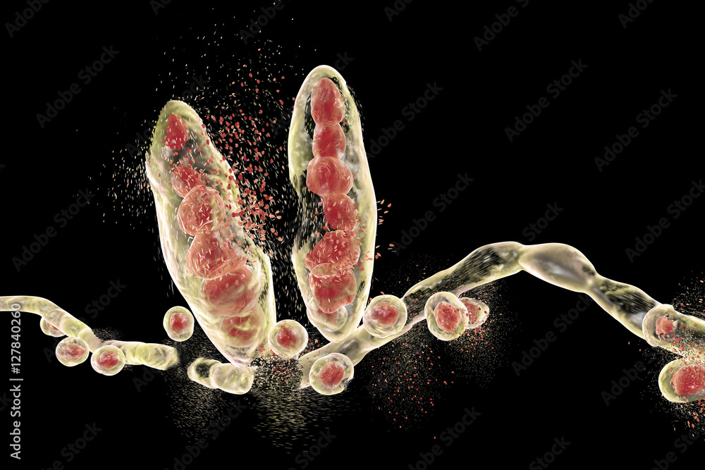 Destruction of fungus Trichophyton mentagrophytes which causes athlete ...